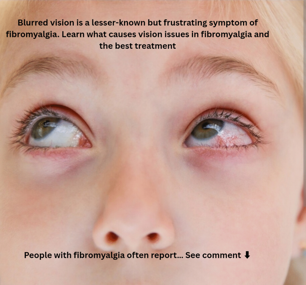 Dry eyes and mouth due to fibromyalgia – fibromyalgia